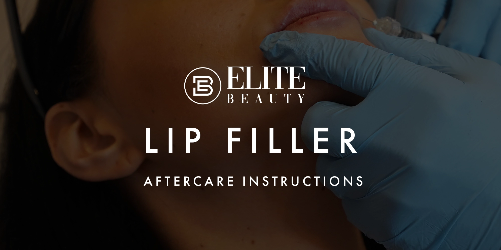 LIP FILLER AFTER TREATMENT CARE | Elite Beauty Toledo